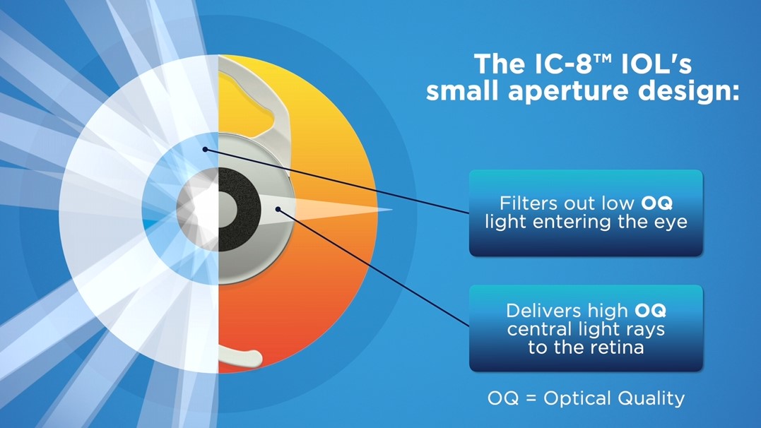 Small Aperture Optics - IC-8